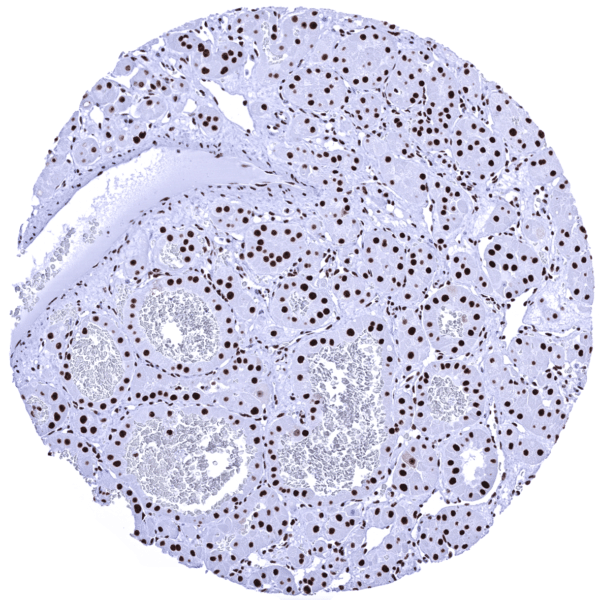 Cancer Tissue Gallery Nucleolin - MS Validated Antibodies