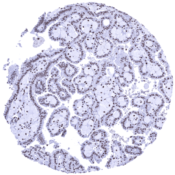 Cancer Tissue Gallery Nucleolin - MS Validated Antibodies