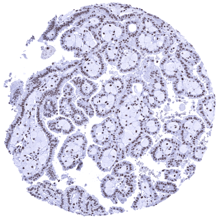 Cancer Tissue Gallery Nucleolin - MS Validated Antibodies