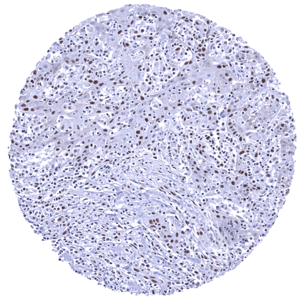 Cancer Tissue Gallery Nucleolin - MS Validated Antibodies