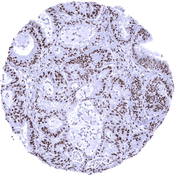 Cancer Tissue Gallery Nucleolin - MS Validated Antibodies