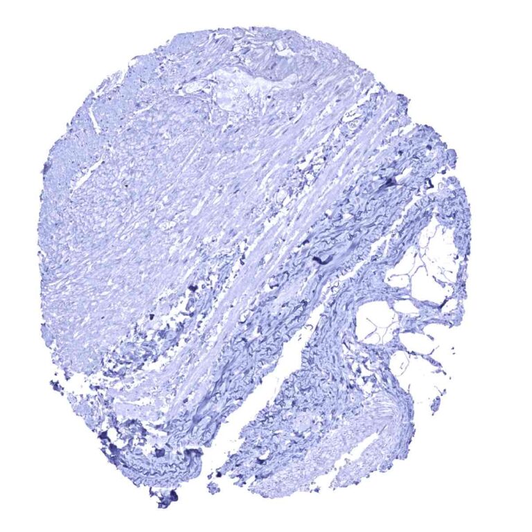 Normal Tissue Gallery CD23 - MS Validated Antibodies