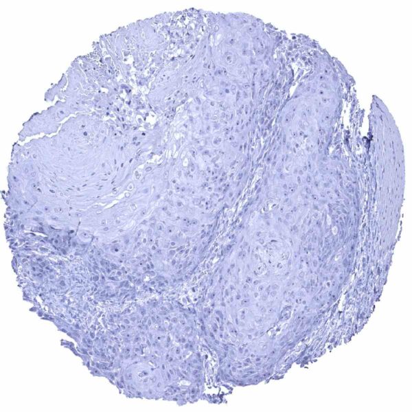 Cancer Tissue Gallery CD23 - MS Validated Antibodies