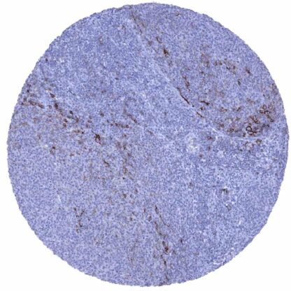 Cancer Tissue Gallery CD23 - MS Validated Antibodies