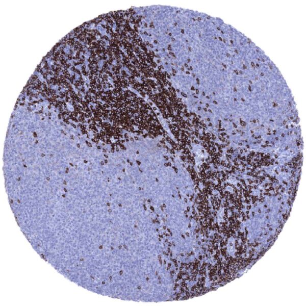 Cancer Tissue Gallery CD3 - MS Validated Antibodies