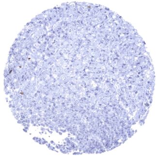 Cancer Tissue Gallery CD3 - MS Validated Antibodies