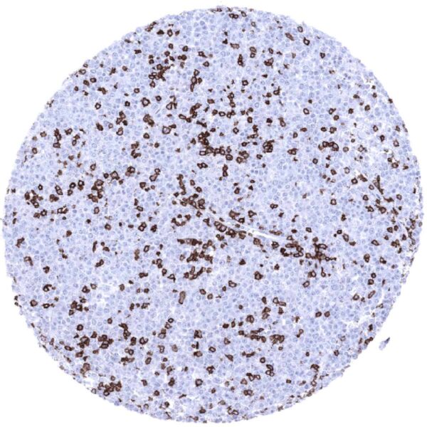 Cancer Tissue Gallery CD3 - MS Validated Antibodies