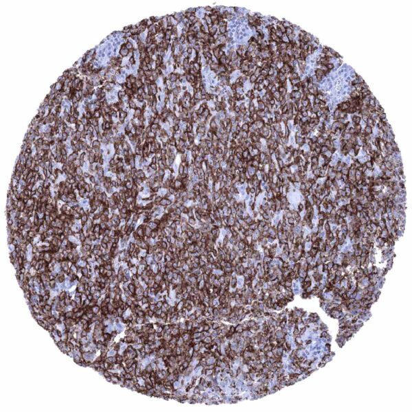 CD23 (MSVA-023M) - MS Validated Antibodies