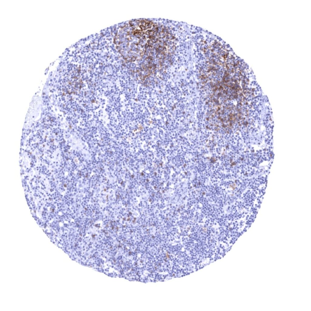 CD23 (MSVA-023M) - MS Validated Antibodies