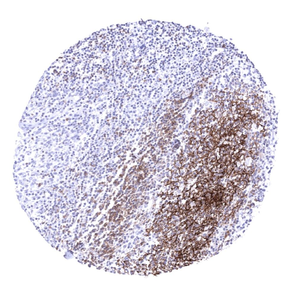 CD23 (MSVA-023M) - MS Validated Antibodies