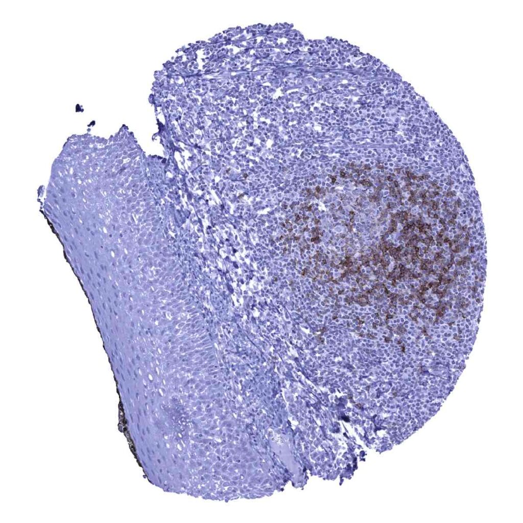 CD23 (MSVA-023M) - MS Validated Antibodies