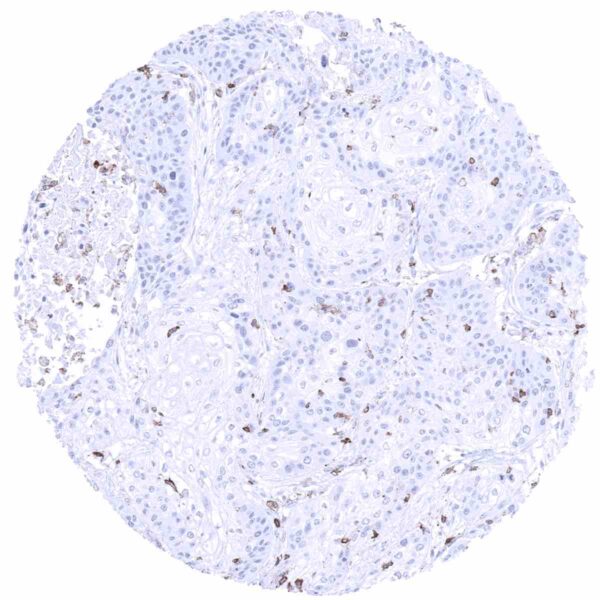 Cancer Tissue Gallery CD45 - MS Validated Antibodies