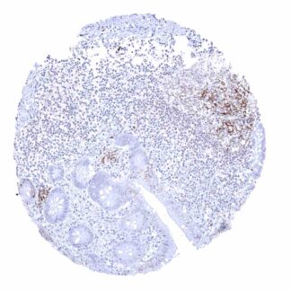 Normal Tissue Gallery GLUT1 - MS Validated Antibodies