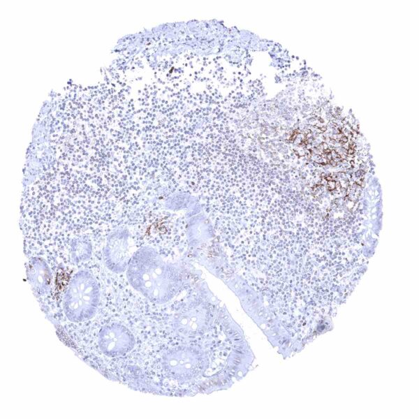 Normal Tissue Gallery GLUT1 - MS Validated Antibodies