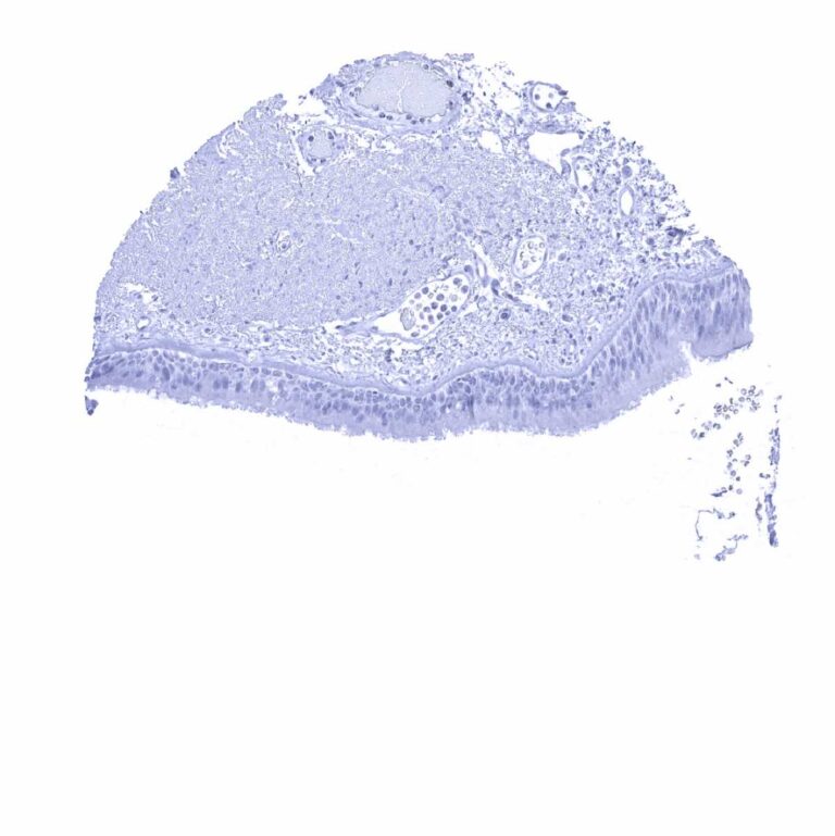Uroplakin 1A Normal Tissue Gallery - MS Validated Antibodies
