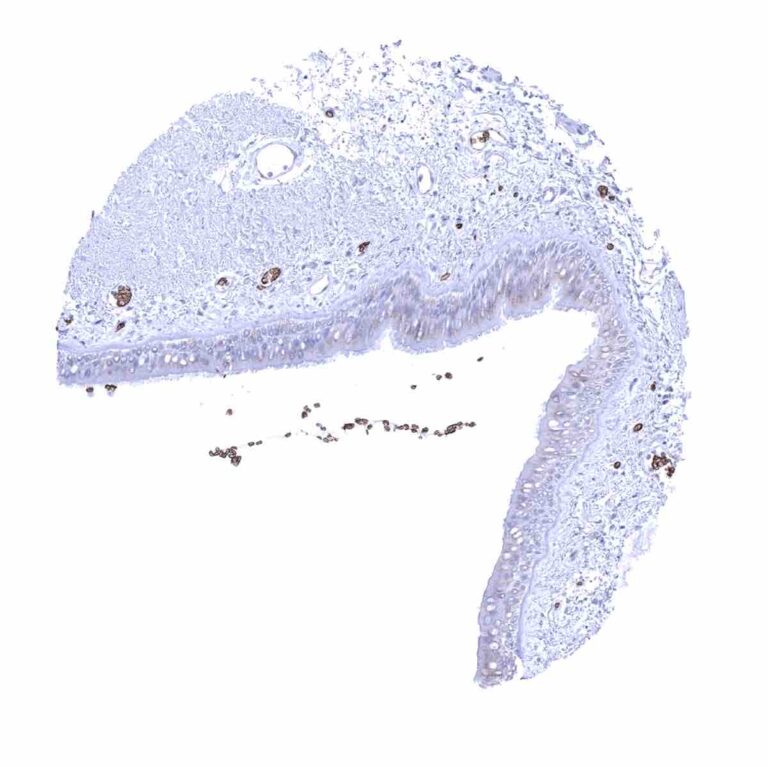 Normal Tissue Gallery GLUT1 - MS Validated Antibodies