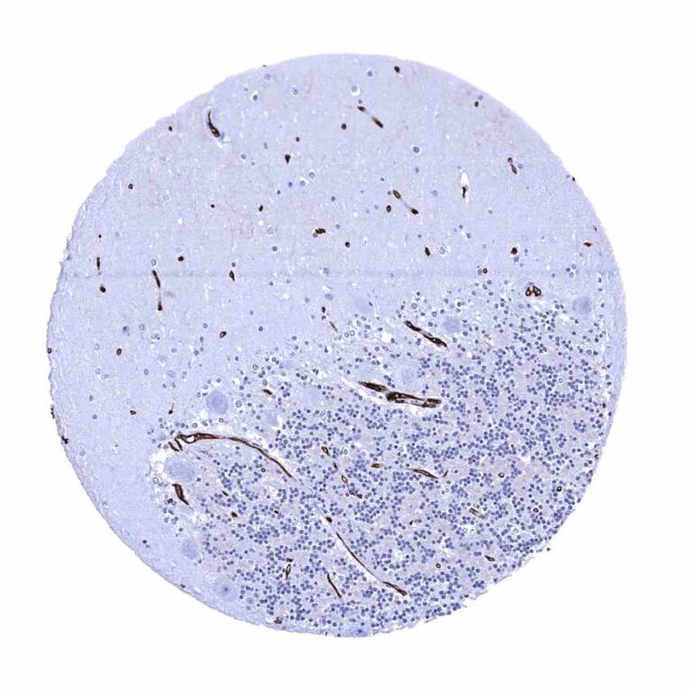 Normal Tissue Gallery GLUT1 - MS Validated Antibodies