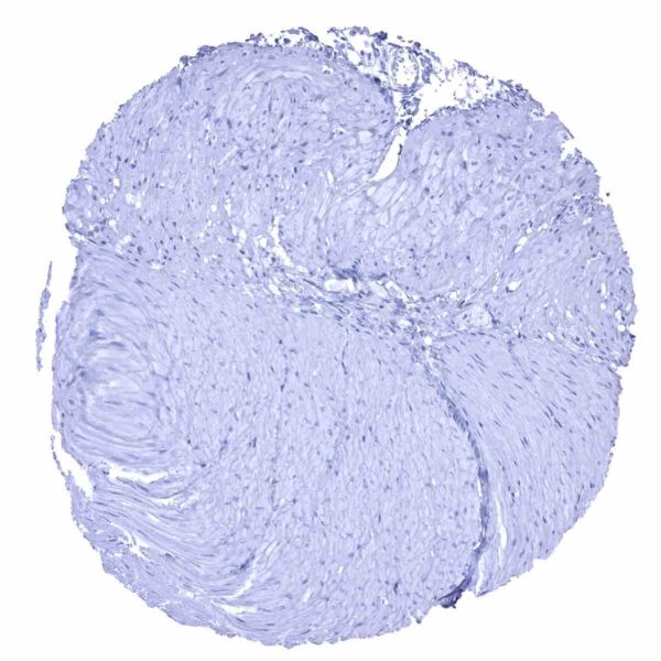 Desmoglein 1 Normal Tissue Gallery - MS Validated Antibodies