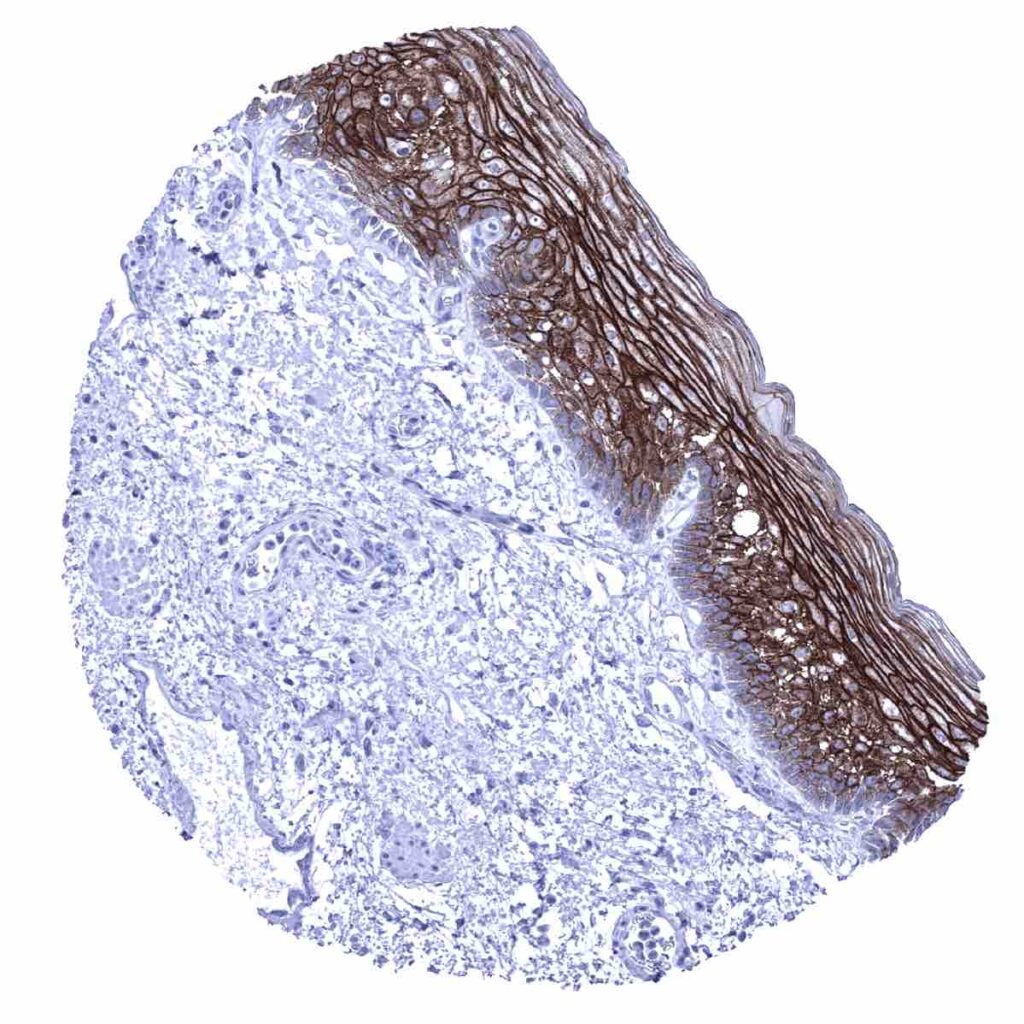 Desmoglein 1 (MSVA-544M) - MS Validated Antibodies