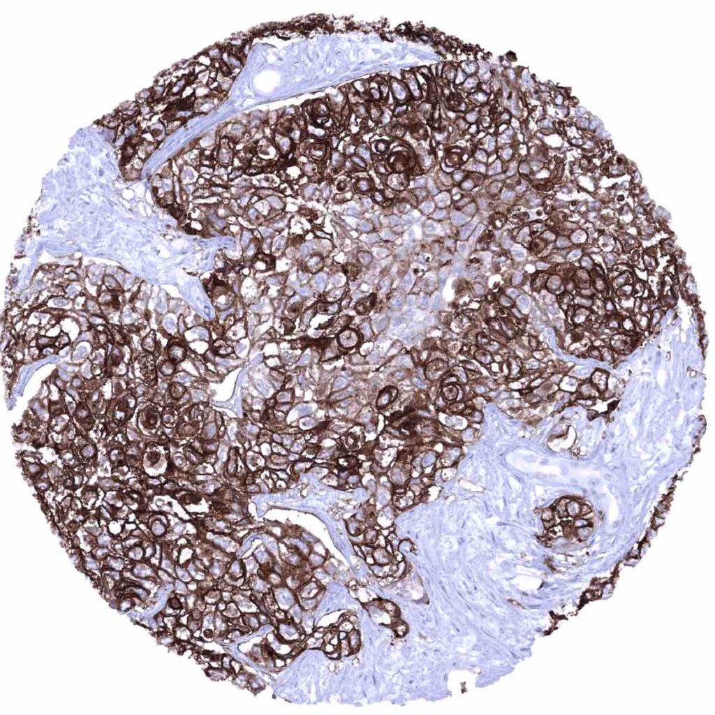 Uroplakin 1A (MSVA-735M) - MS Validated Antibodies