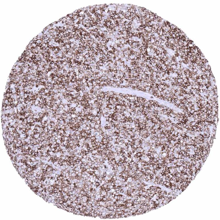 Cancer Tissue Gallery CD45 - MS Validated Antibodies