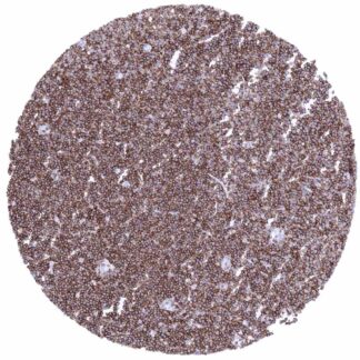 Cancer Tissue Gallery CD45 - MS Validated Antibodies