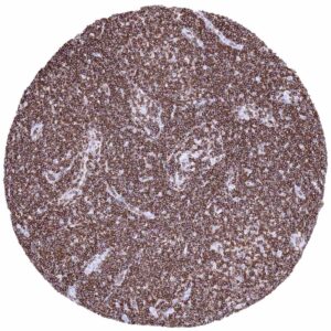 Cancer Tissue Gallery CD45 - MS Validated Antibodies