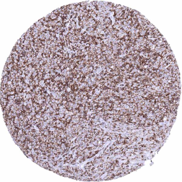 Cancer Tissue Gallery CD45 - MS Validated Antibodies