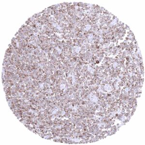 Cancer Tissue Gallery CD45 - MS Validated Antibodies