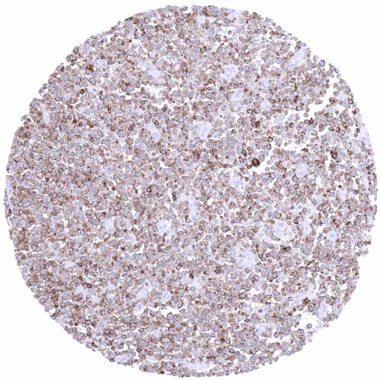 Cancer Tissue Gallery CD45 - MS Validated Antibodies