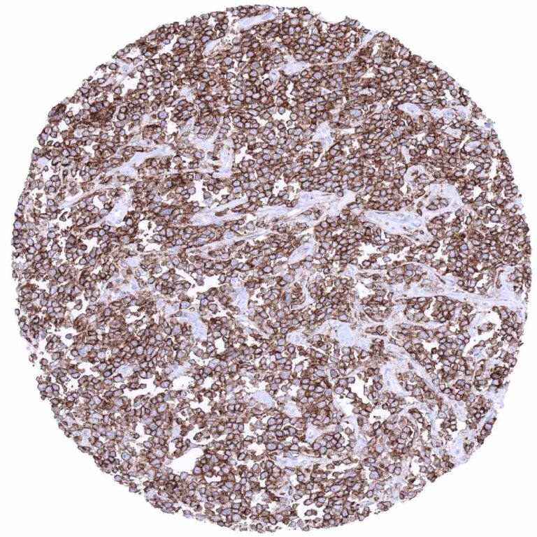 Cancer Tissue Gallery CD45 - MS Validated Antibodies