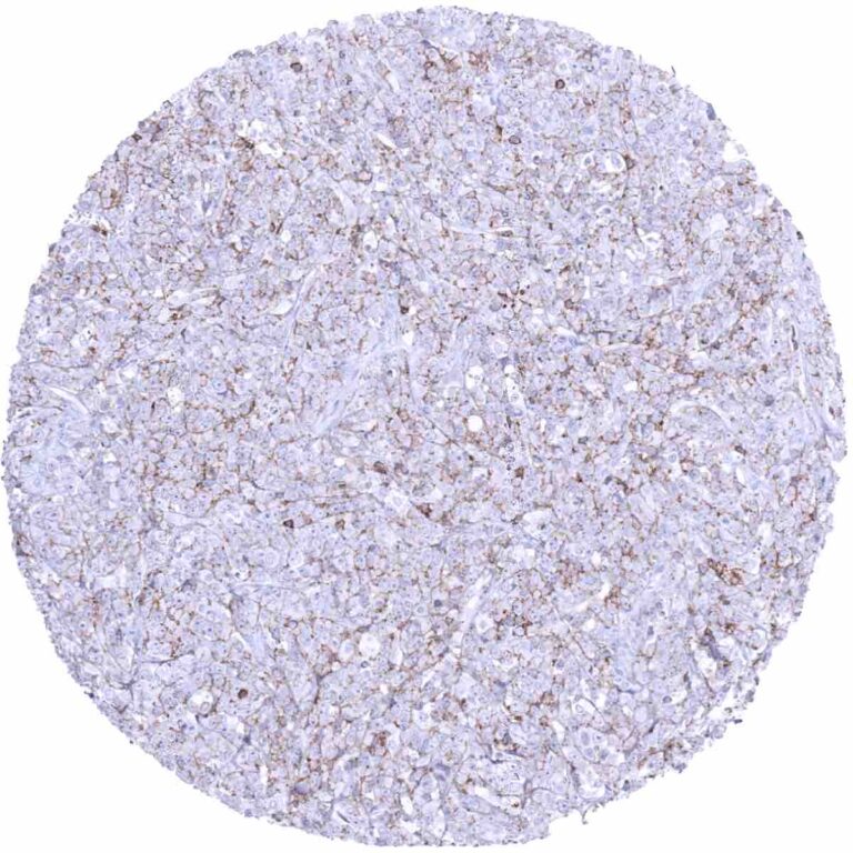 Cancer Tissue Gallery CD45 - MS Validated Antibodies