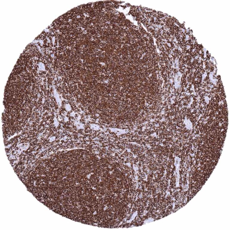 Cancer Tissue Gallery CD45 - MS Validated Antibodies