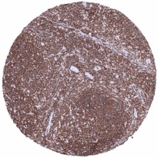 Cancer Tissue Gallery CD45 - MS Validated Antibodies