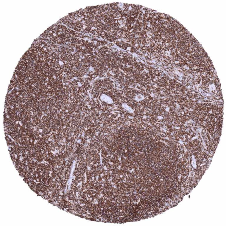 Cancer Tissue Gallery CD45 - MS Validated Antibodies