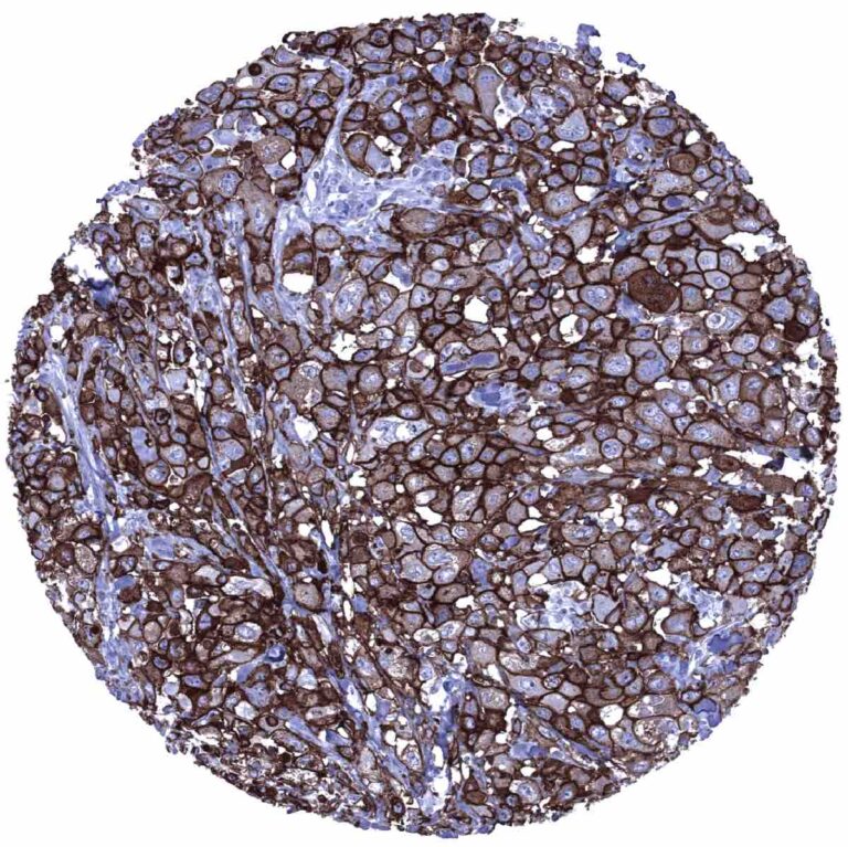 GLUT1 (MSVA-401R) - MS Validated Antibodies