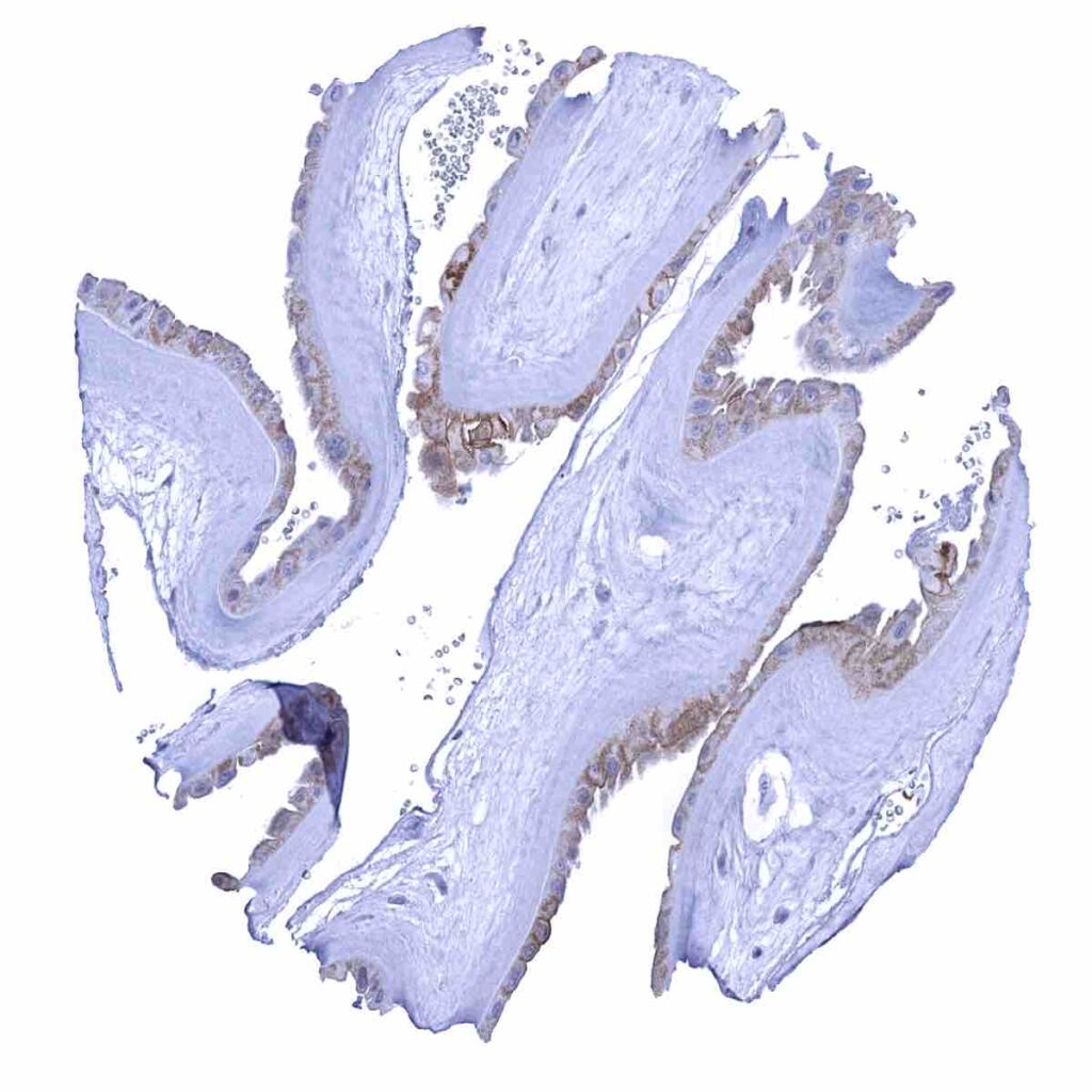 Desmoglein 1 (MSVA-544M) - MS Validated Antibodies
