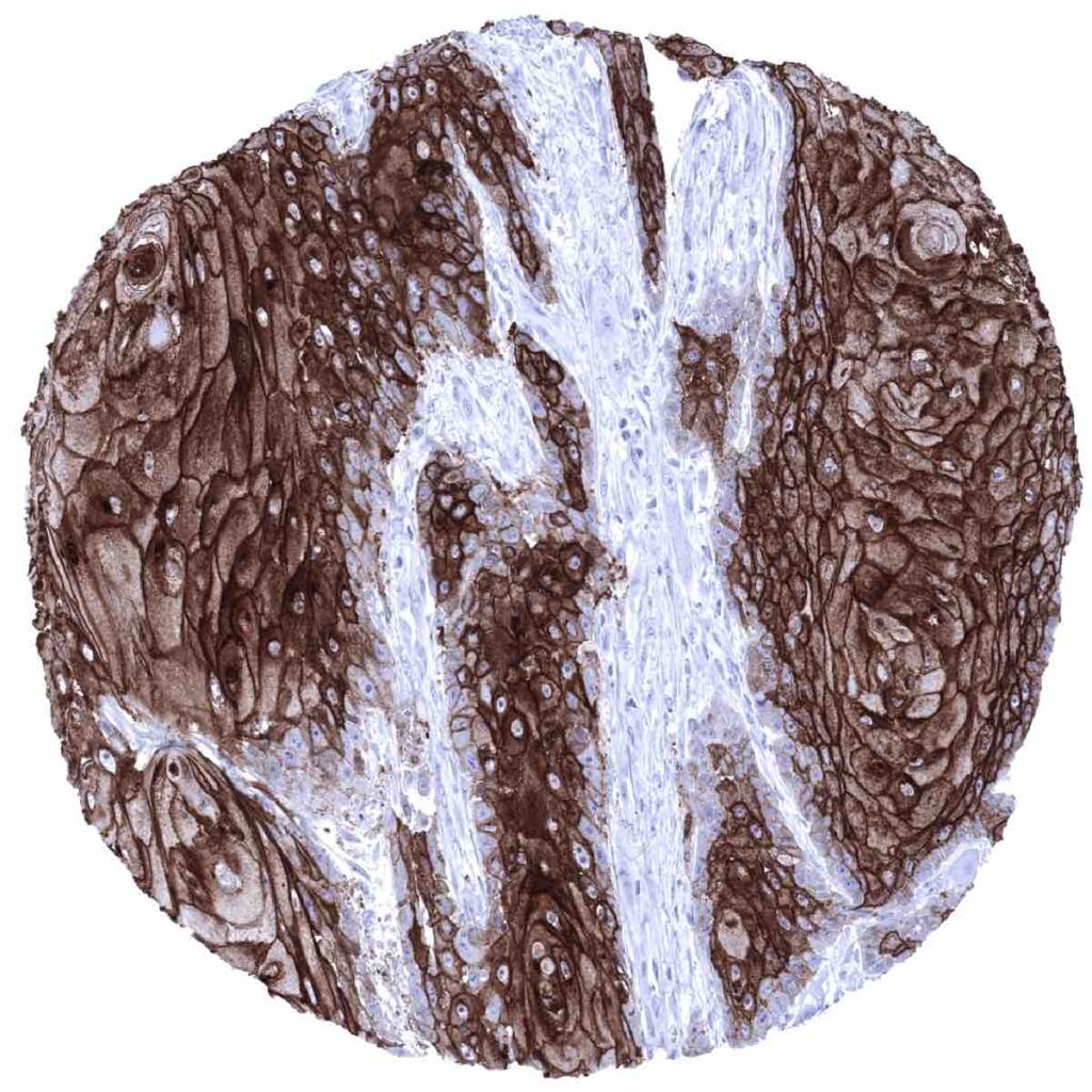 Desmoglein 1 (MSVA-544M) - MS Validated Antibodies