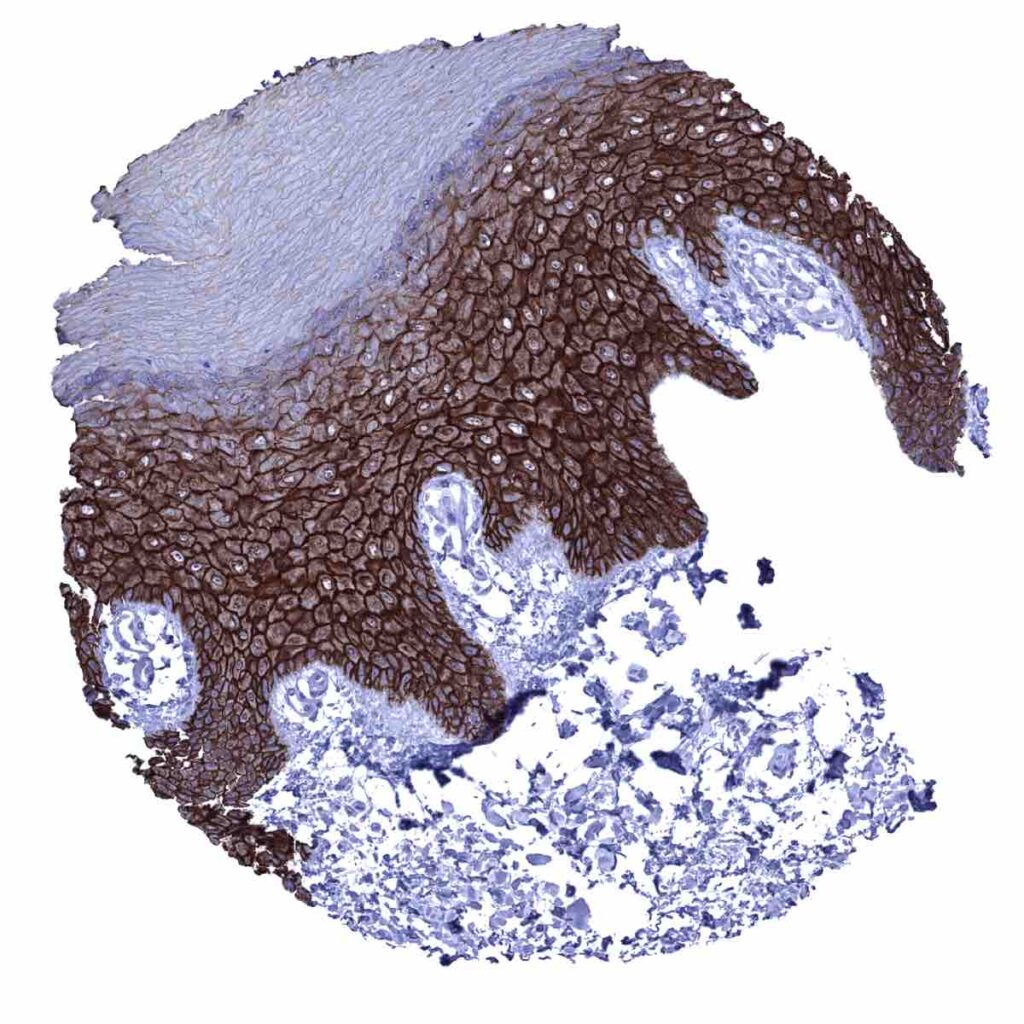 Desmoglein 1 (MSVA-544M) - MS Validated Antibodies