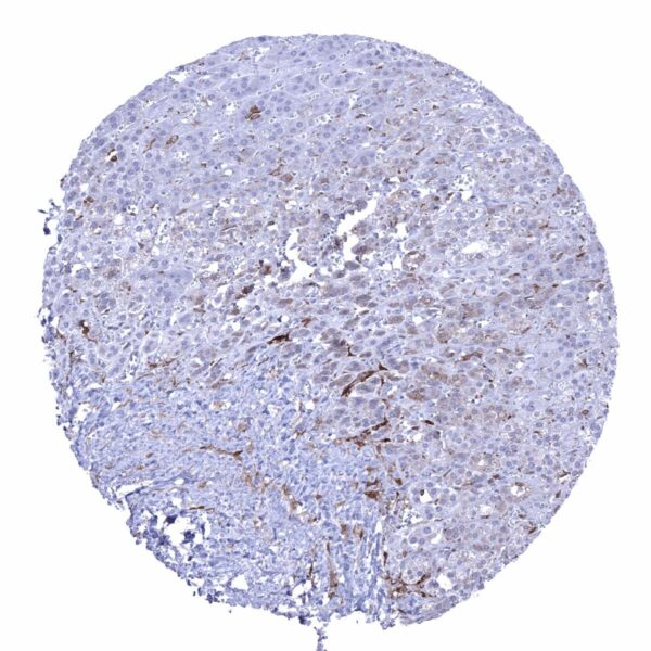 Normal Tissue Gallery Glutamine Synthetase - MS Validated Antibodies