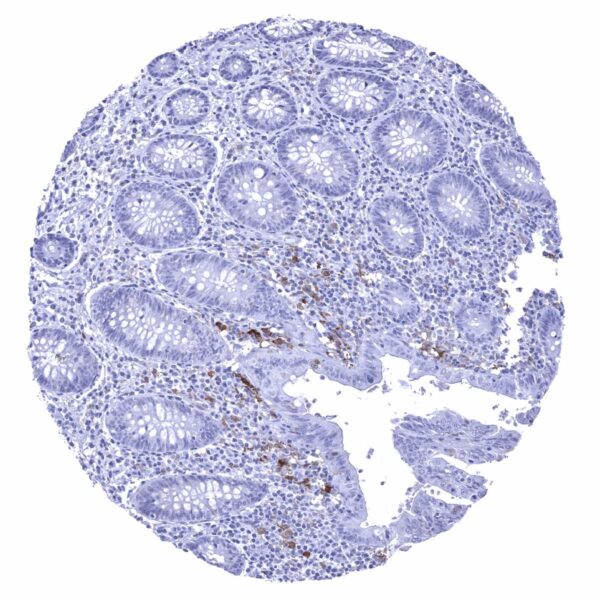Normal Tissue Gallery Glutamine Synthetase - MS Validated Antibodies