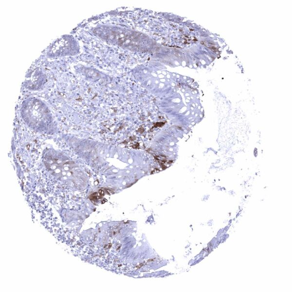 Normal Tissue Gallery Glutamine Synthetase - MS Validated Antibodies