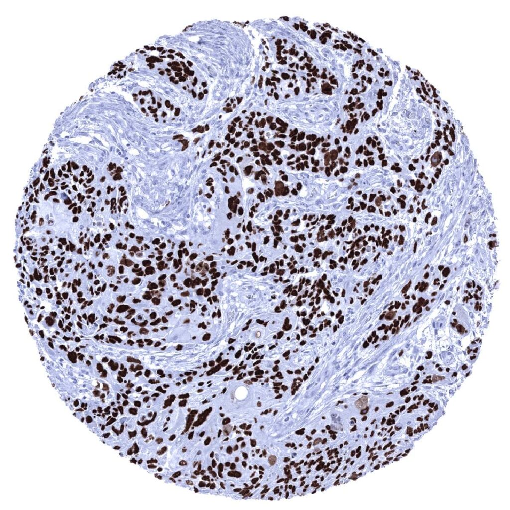 p63 (MSVA-063R) - MS Validated Antibodies