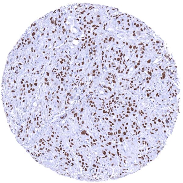 Cancer Tissue Gallery MCM3 - MS Validated Antibodies