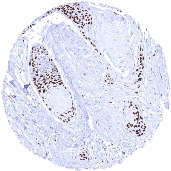 Cancer Tissue Gallery MCM7 - MS Validated Antibodies