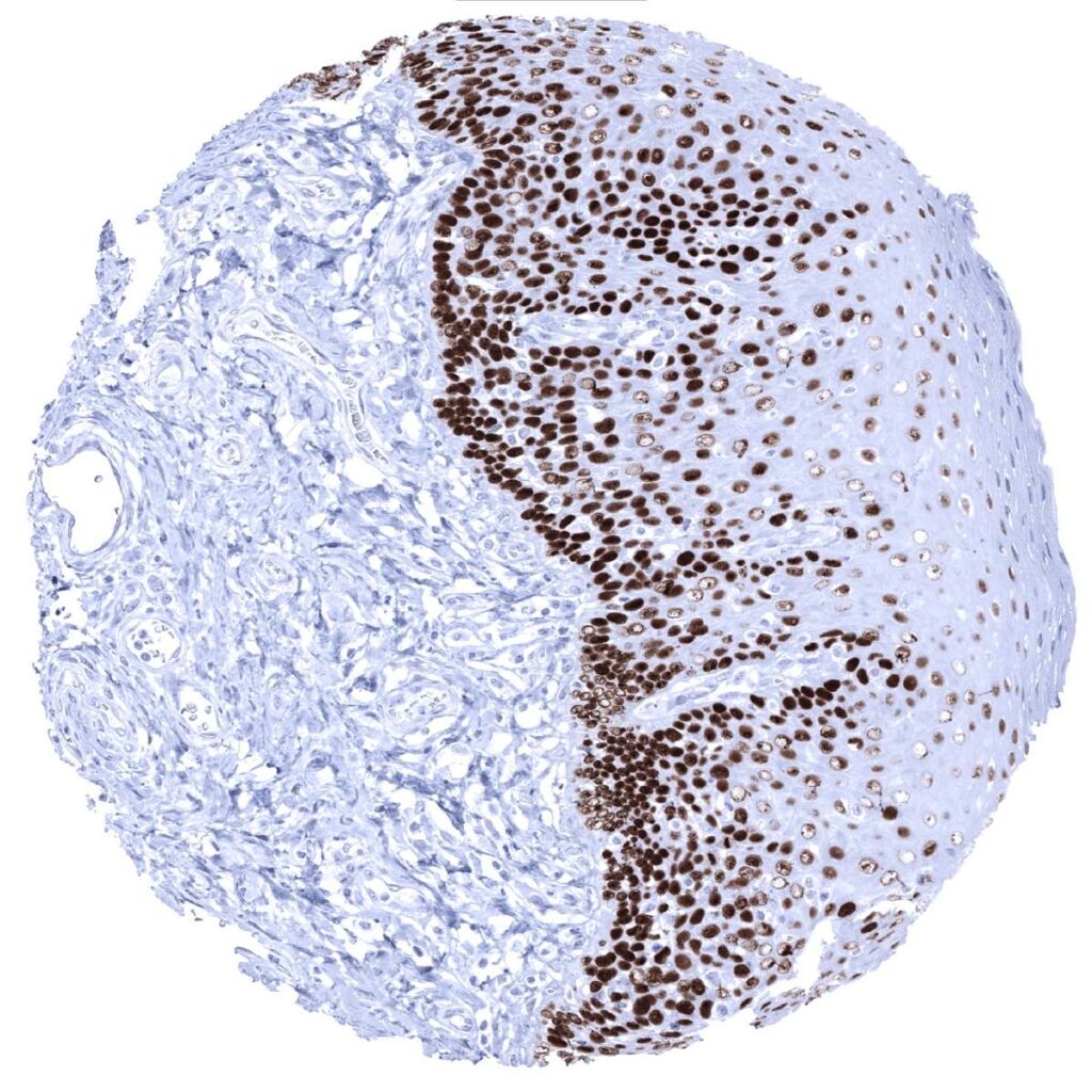 p63 (MSVA-063R) - MS Validated Antibodies