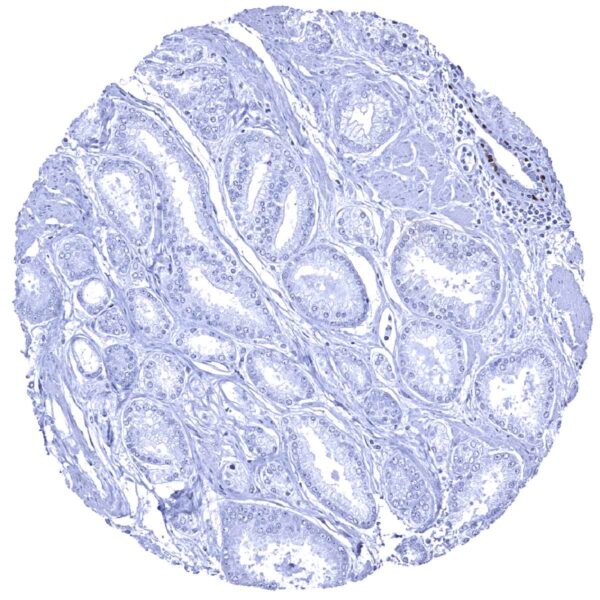 Cancer Tissue Gallery p63 - MS Validated Antibodies
