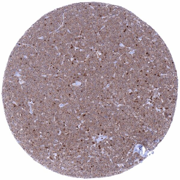 Cancer Tissue Gallery ZAP-70 - MS Validated Antibodies