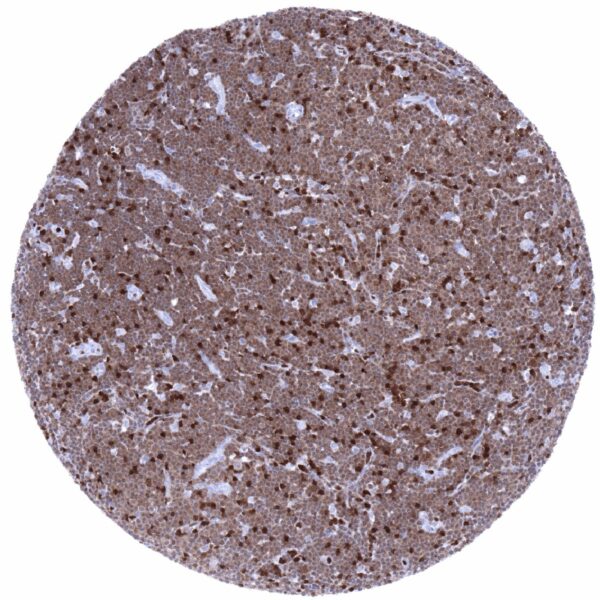 Cancer Tissue Gallery ZAP-70 - MS Validated Antibodies