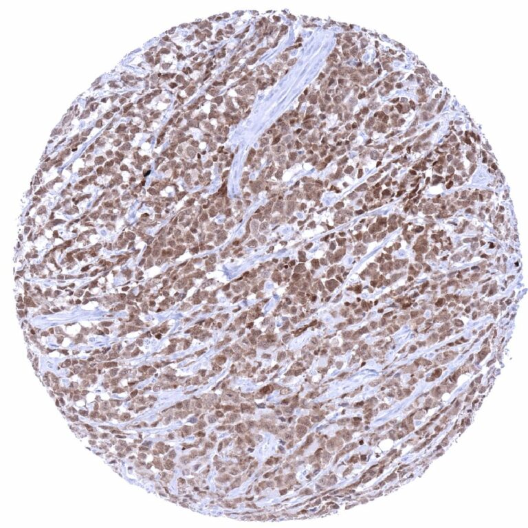 Cancer Tissue Gallery ZAP-70 - MS Validated Antibodies
